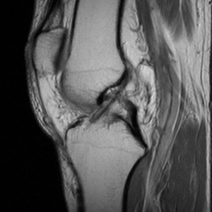 Basic-knee-mri