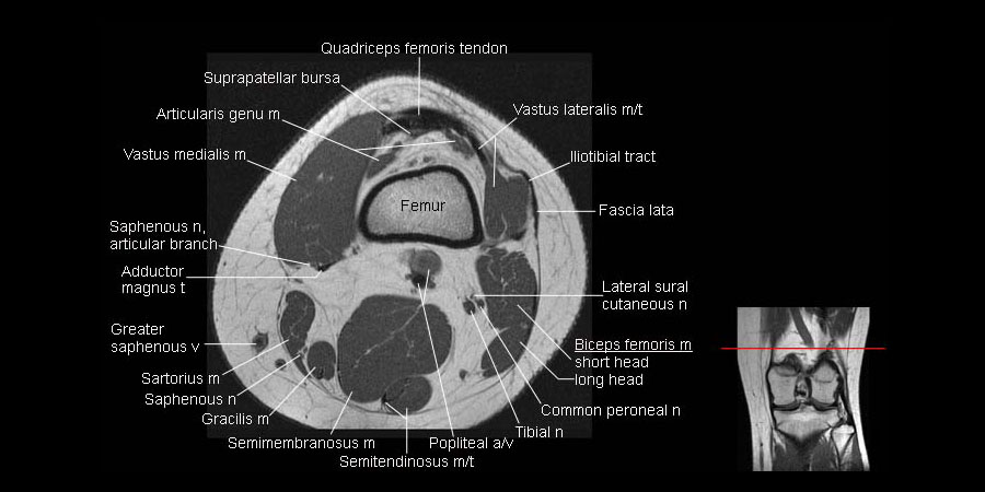 Mri Knee Axial Mri Knee Joint Magnetic Resonance Imaging
