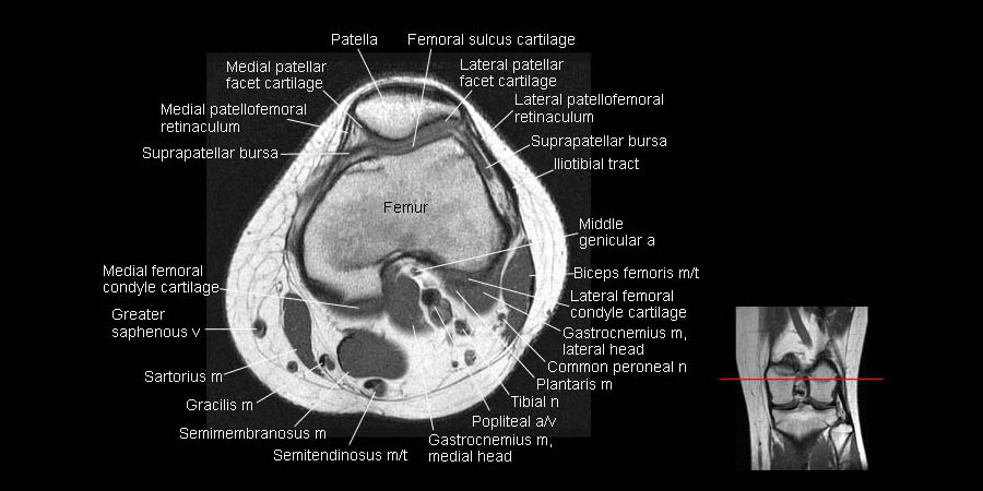 Knee