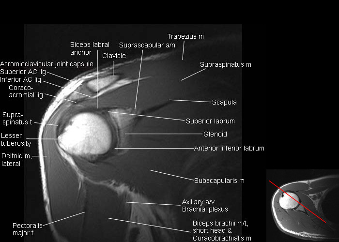 Shoulder Joint Anatomy Mri